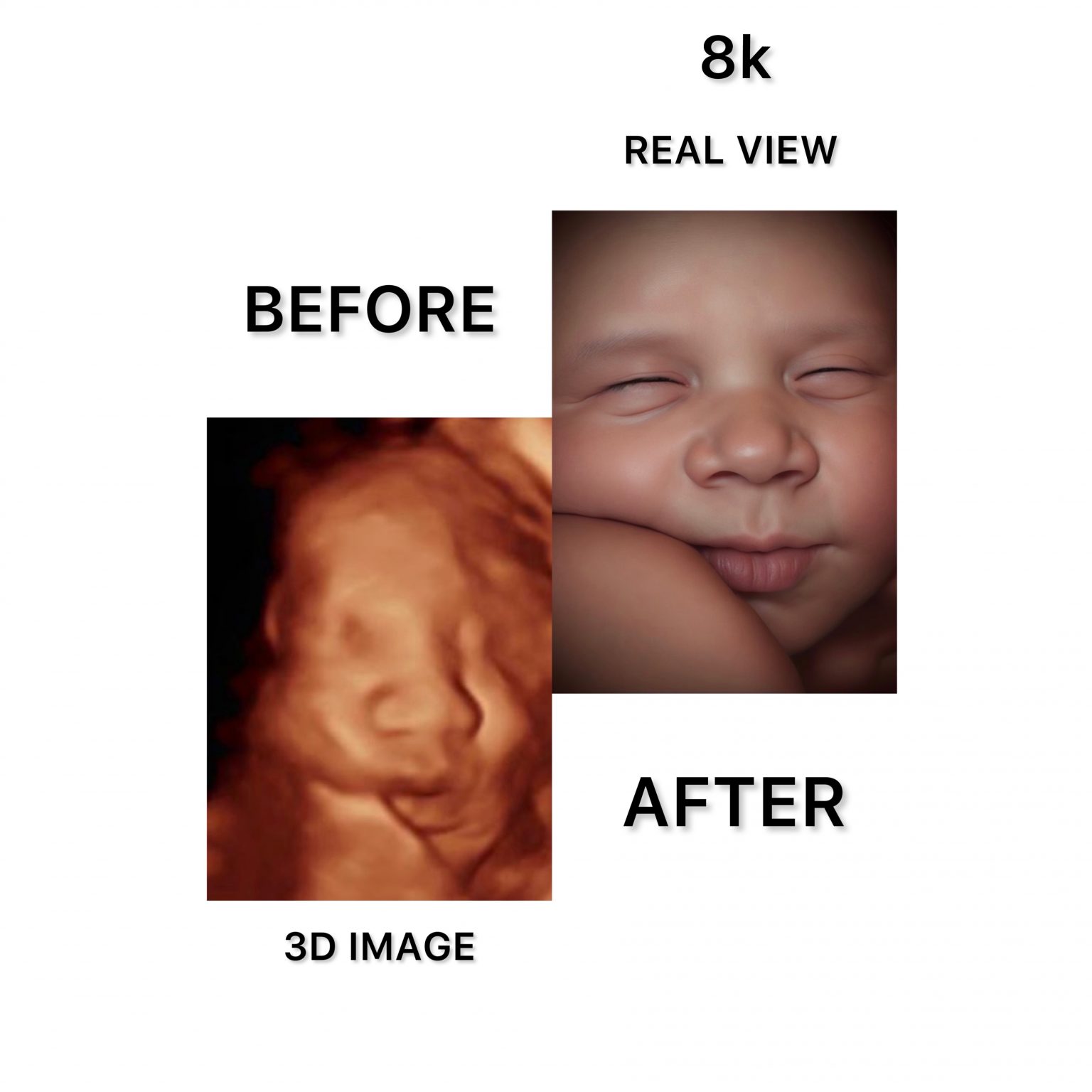 1st Glimpse Inc. 3D/4D/5D HD LIVE Ultrasound in NYC | Brooklyn | Queens ...